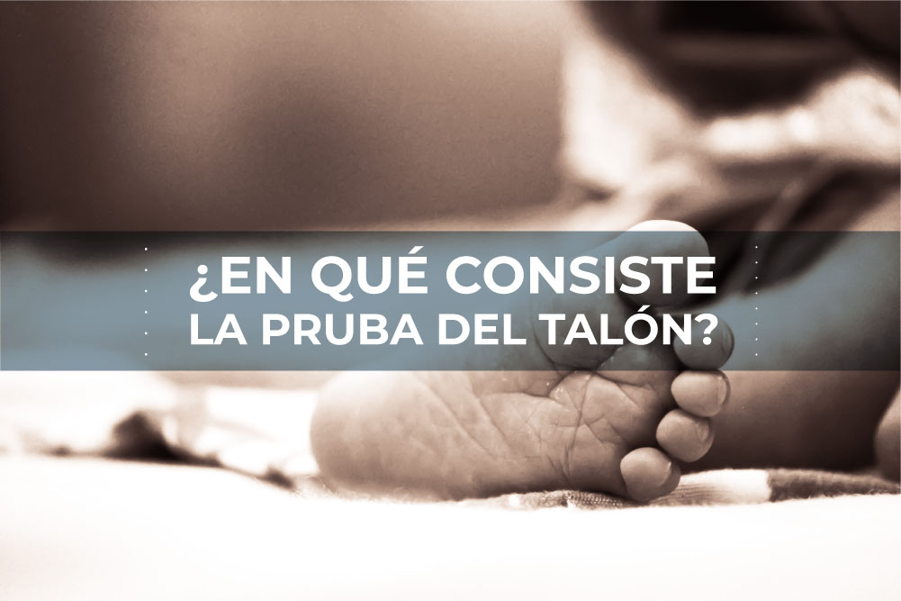 ¿En qué consiste la prueba del talón? – Comat Matronas